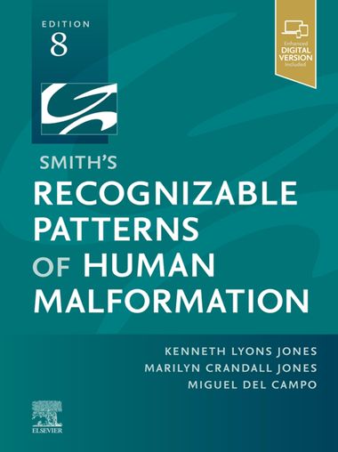 Smith's Recognizable Patterns of Human Malformation - E-Book | Kenneth ...