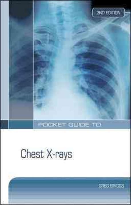 Pocket Guide to Chest X-Rays | - 교보문고
