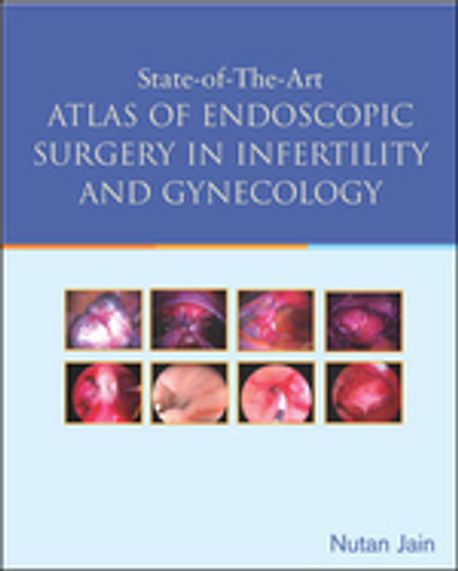 State of the Art Atlas of Endoscopic Surgery in Infertility and ...