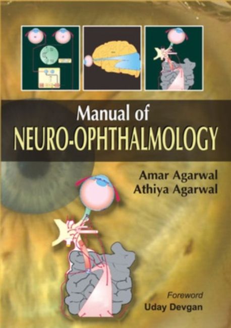 Manual of Neuro-Ophthalmology | Agarwal, Amar - 교보문고