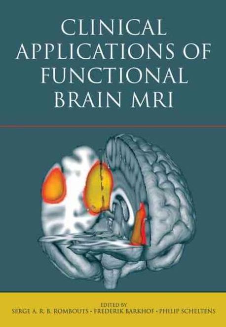 Clinical Applications of Functional Brain MRI | Rombouts PhD, Serge A.R ...