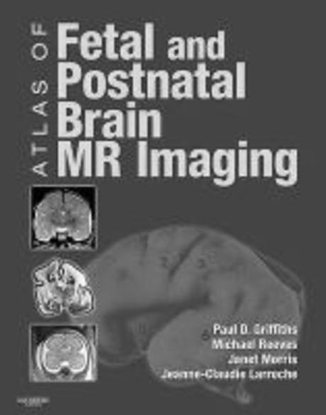Atlas Of Fetal And Postnatal Brain Mr | Paul D. Griffiths - 교보문고