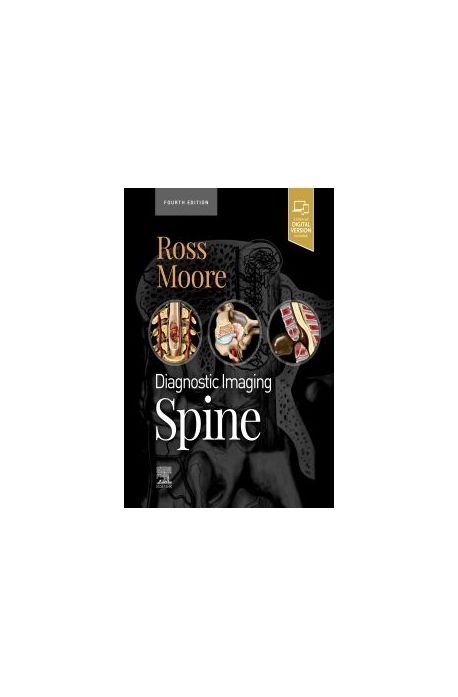 Diagnostic Imaging: Spine | Ross, Jeffrey S. - 교보문고