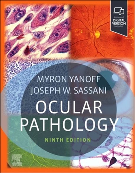 Ocular Pathology | Yanoff, Myron - 교보문고