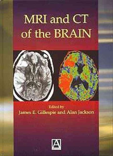 Mri and Ct of the Brain | Gillespie, James E. (Edt)/ Jackson, Alan (Edt ...