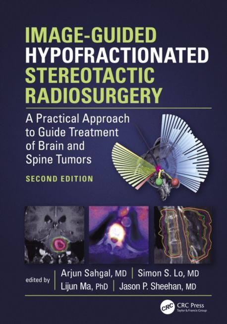 Image-Guided Hypofractionated Stereotactic Radiosurgery | Sahgal, Arjun ...