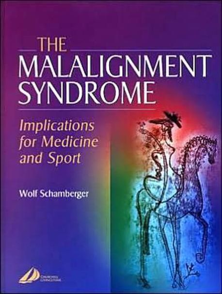 Malalignment Syndrome : Biomechanical and Clinical Implications for ...