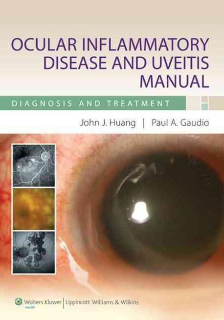 Ocular Inflammatory Disease and Uveitis Manual | Huang, John J. - 교보문고