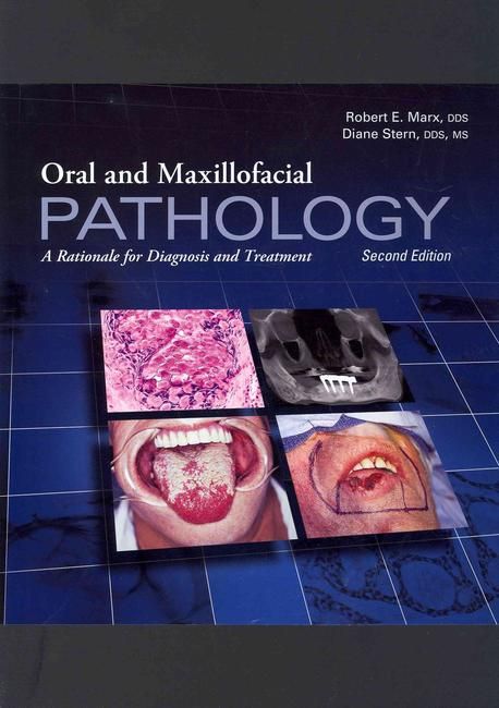 Oral and Maxillofacial Pathology | Marx, Robert E. - 교보문고