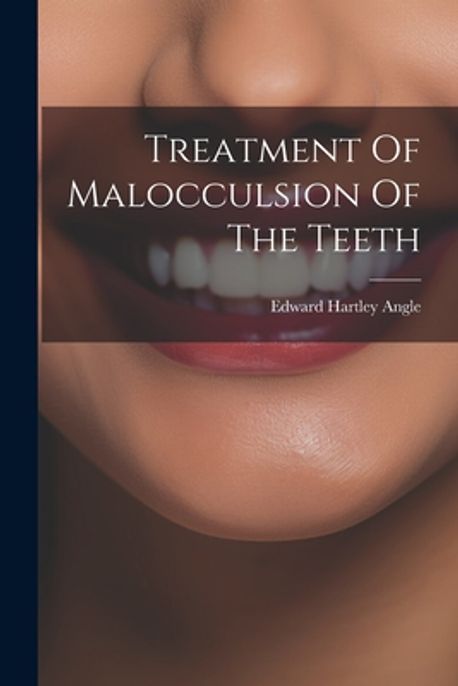Treatment Of Malocculsion Of The Teeth | Angle, Edward Hartley - 교보문고