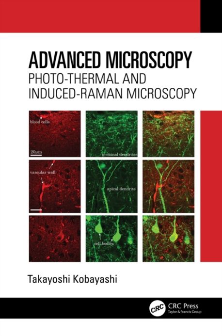 Advanced Microscopy | Kobayashi, Takayoshi - 교보문고