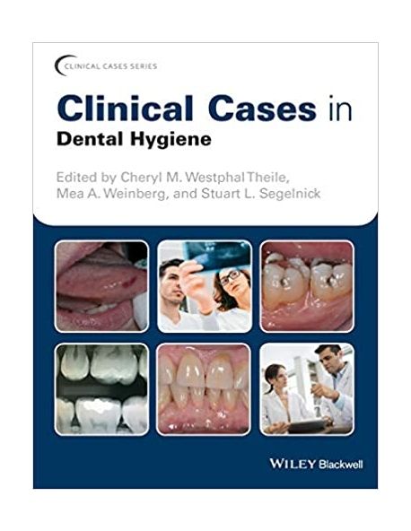 Clinical Cases in Dental Hygiene | Theile, Cheryl M. Westphal (EDT) - 교보문고