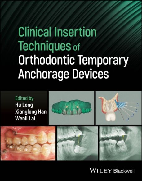 Clinical Insertion Techniques of Orthodontic Temporary Anchorage ...