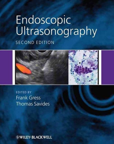 Endoscopic Ultrasonography | Gress, Frank - 교보문고