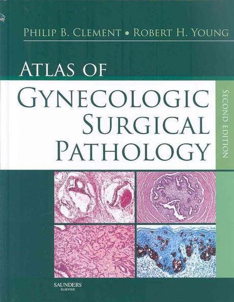 Atlas Of Gynecologic Surgical Pathology. 2Nd Ed. | Clement, Philip B ...