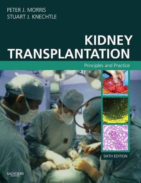Kidney Transplantation: Principles And Practice. 6Th Ed. | Morris ...