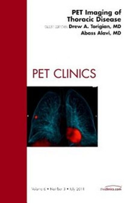 PET Imaging of Thoracic Disease | Torigian, Drew A. - 교보문고