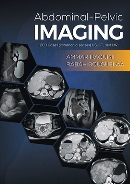 Abdominal-Pelvic Imaging | Haouimi, Ammar - 교보문고