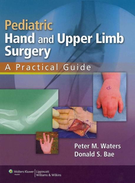 Pediatric Hand and Upper Limb Surgery | Waters, Peter M. - 교보문고