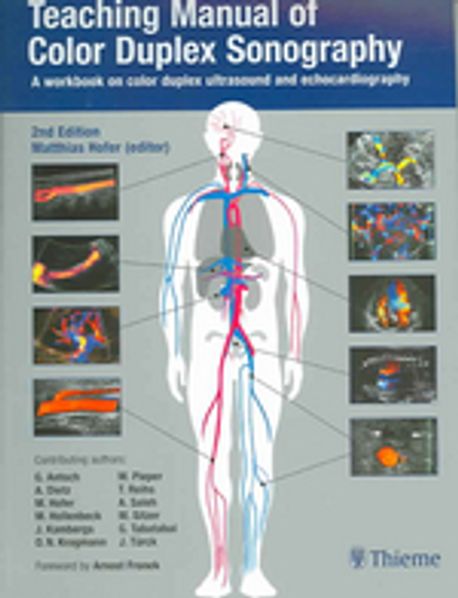 Teaching Manual Of Color Duplex Sonography : A workbook on color duplex ...