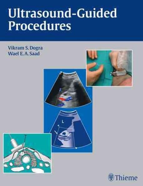 Ultrasound-Guided Procedures | Dogra, Vikram S./Saad, Wael E. A./ - 교보문고