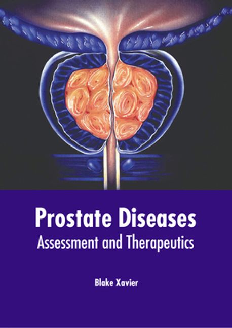 Prostate Diseases | Xavier, Blake - 교보문고
