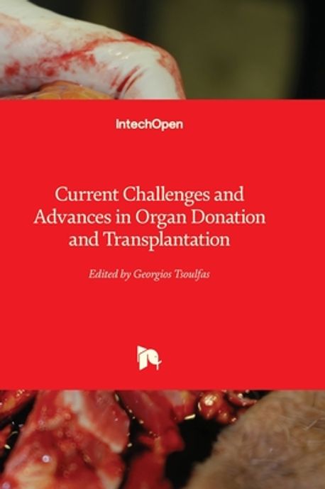 Current Challenges and Advances in Organ Donation and Transplantation ...