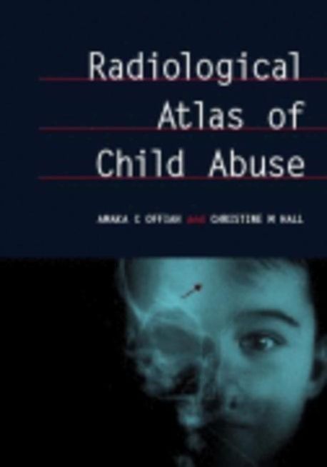 Radiological Atlas of Child Abuse | Offiah, Amaka C. - 교보문고