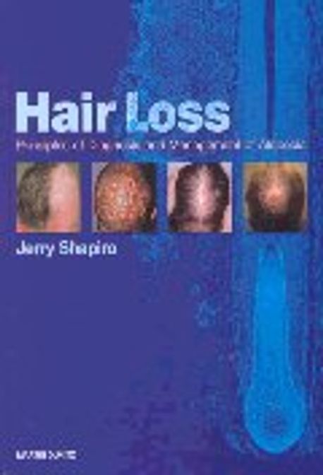 Hair Loss | Shapiro, Jerry - 교보문고
