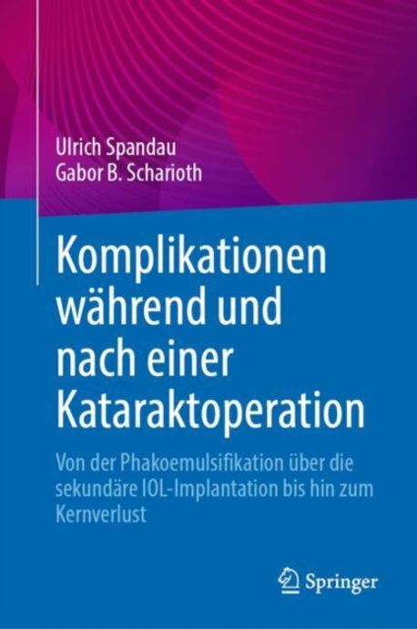 Komplikationen waehrend und nach einer Kataraktoperation | Scharioth ...