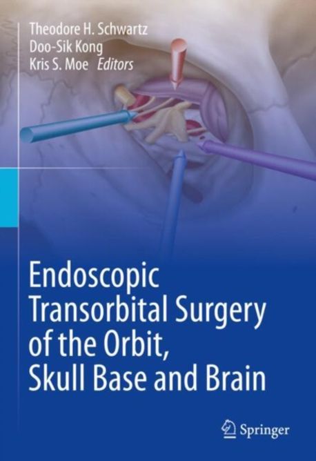 Endoscopic Transorbital Surgery of the Orbit, Skull Base and Brain | Schwartz, Theodore H. - 교보문고