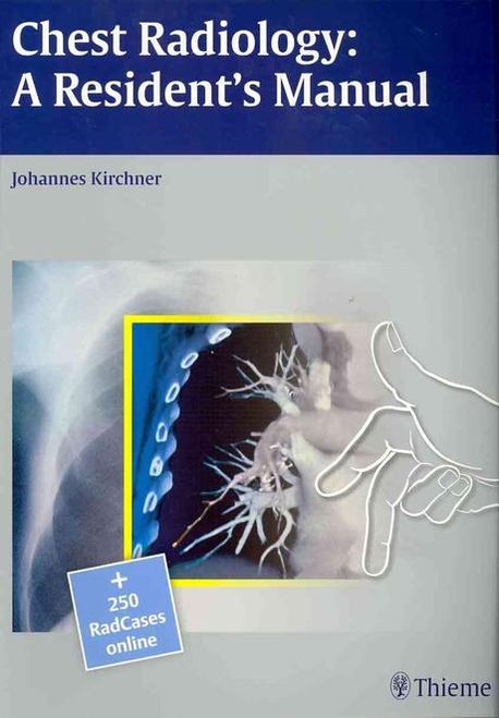 Chest Radiology | Kirchner, Johannes - 교보문고