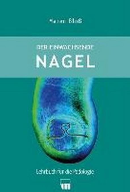 Der eingewachsenen Nagel | Bloss, Maren - 교보문고