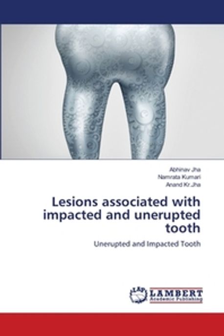 Lesions associated with impacted and unerupted tooth | Jha, Abhinav - 교보문고