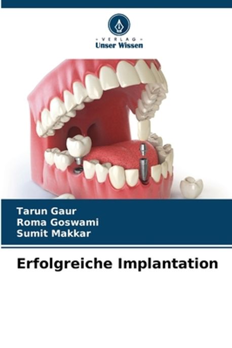 Erfolgreiche Implantation | Gaur, Tarun - 교보문고