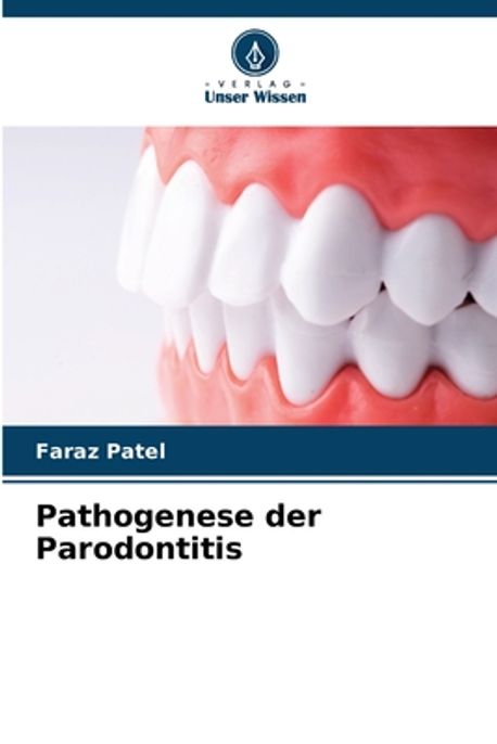 Pathogenese der Parodontitis | Patel, Faraz - 교보문고