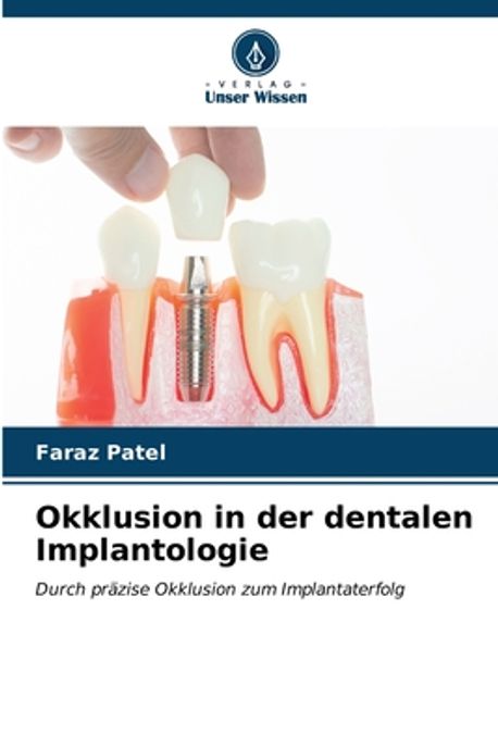 Okklusion in der dentalen Implantologie | Patel, Faraz - 교보문고