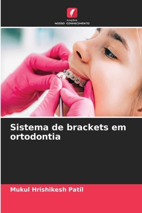 Sistema de brackets em ortodontia | Hrishikesh Patil, Mukul - 교보문고