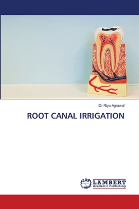 Root Canal Irrigation | Agrawal, Riya - 교보문고
