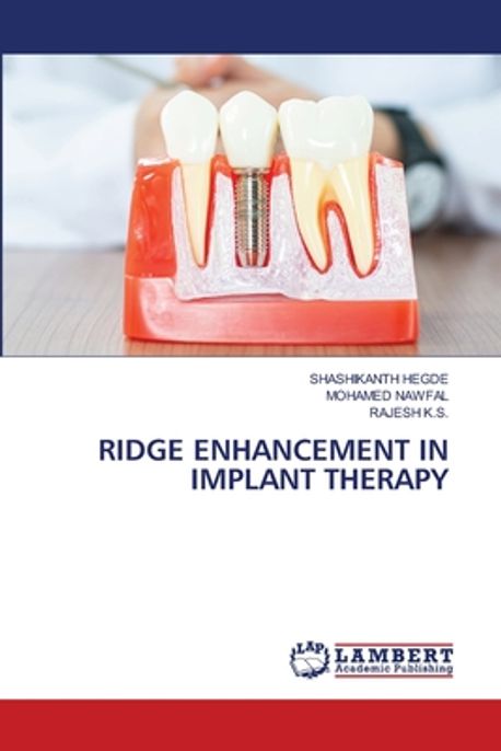 Ridge Enhancement in Implant Therapy | Hegde, Shashikanth - 교보문고