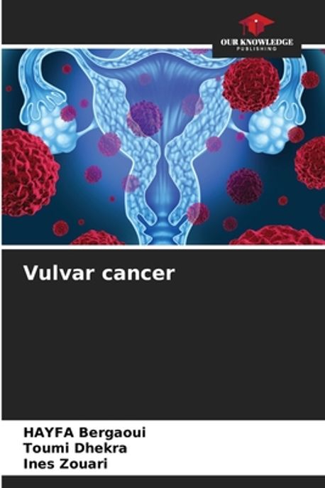 Vulvar cancer | Bergaoui, Hayfa - 교보문고