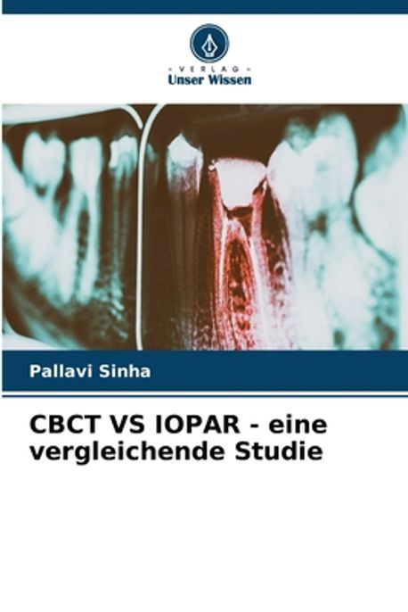 CBCT VS IOPAR - eine vergleichende Studie | Sinha, Pallavi - 교보문고