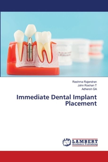 Immediate Dental Implant Placement | Rajendran, Reshma - 교보문고