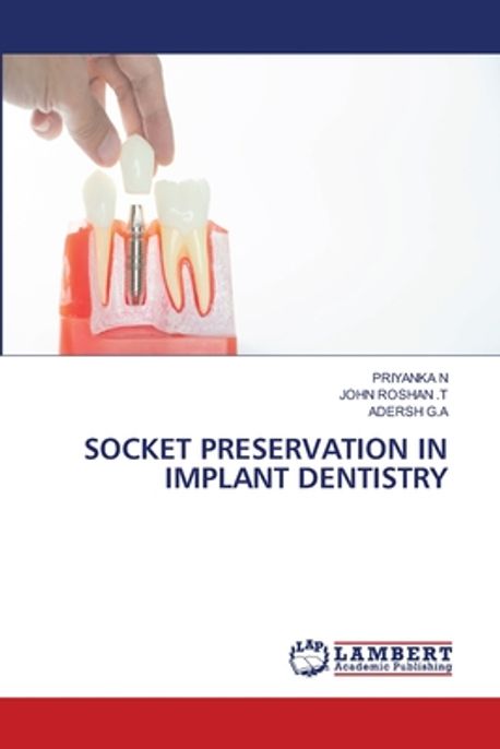 Socket Preservation in Implant Dentistry | N, Priyanka - 교보문고