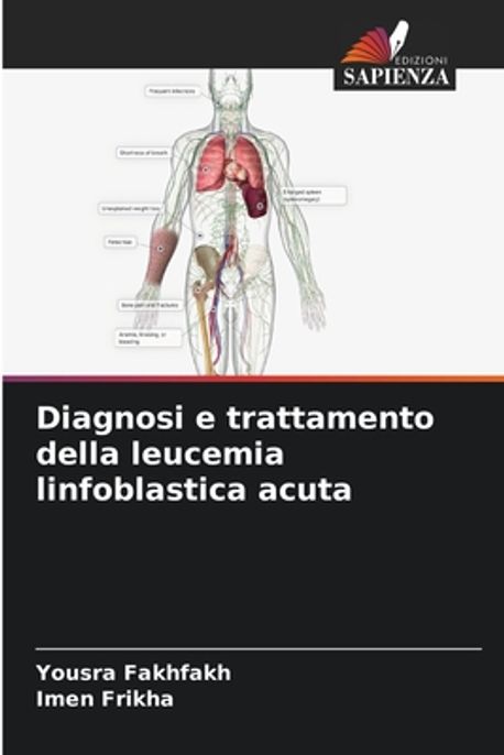 Diagnosi e trattamento della leucemia linfoblastica acuta | Fakhfakh ...