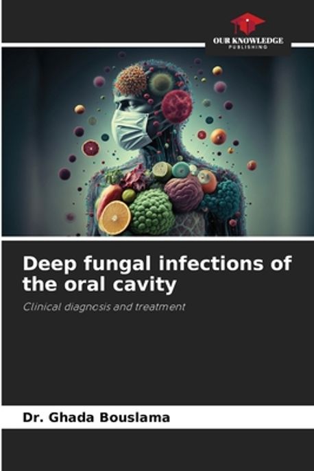 Deep fungal infections of the oral cavity | Bouslama, Ghada - 교보문고