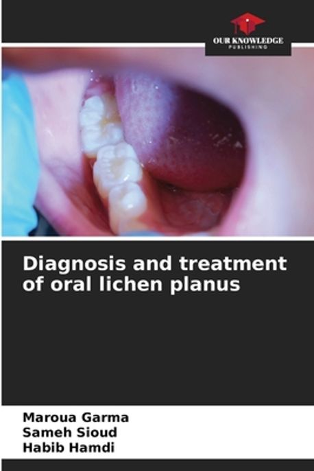 Diagnosis and treatment of oral lichen planus | Garma, Maroua - 교보문고