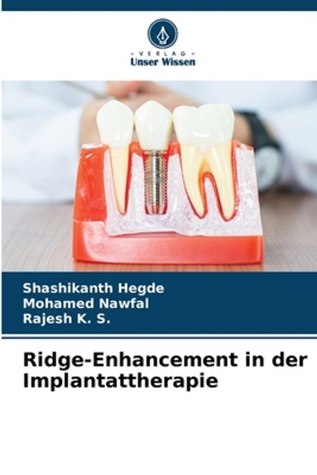 Ridge-Enhancement in der Implantattherapie | Hegde, Shashikanth - 교보문고