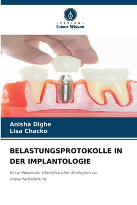 Belastungsprotokolle in Der Implantologie | Dighe, Anisha - 교보문고