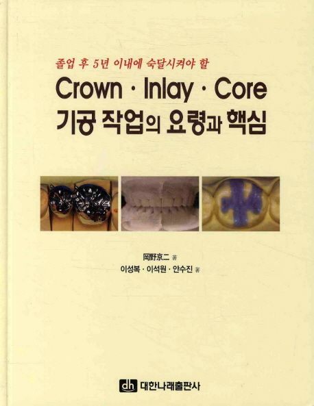 CROWN INLAY CORE 기공작업의 요령과 핵심 | 오카노 쿄지 - 교보문고